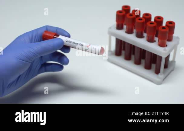 Negative Chloroform test, doctor showing blood sample in tube, health ...