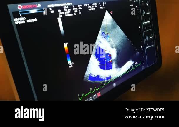 Screen ultrasound machine symbol diagnostics Stock Videos & Footage ...