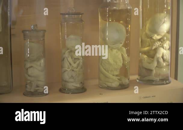 Anatomical specimen Stock Videos & Footage - HD and 4K Video Clips - Alamy