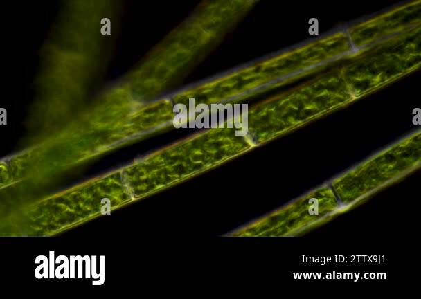 Filamentous Algae Phytoplankton under the microscope. Focusing on ...