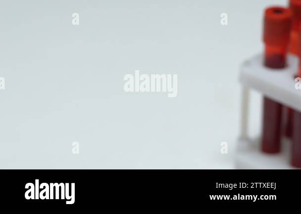 Measles Test, doctor holding blood sample in tube close-up, health ...