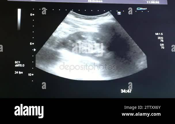 A modern X-ray roentgenogram with moving organs of a patient in a ...