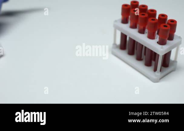 Dengue test Stock Videos & Footage - HD and 4K Video Clips - Alamy