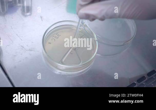 Experiment in the laboratory. Sample selection. Microbiological ...