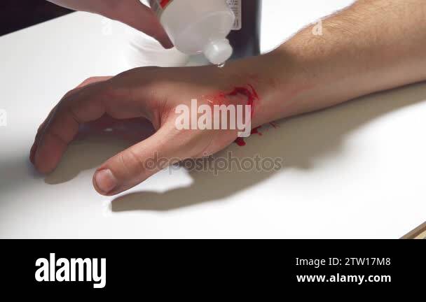 Cut wound infection Stock Videos & Footage - HD and 4K Video Clips - Alamy