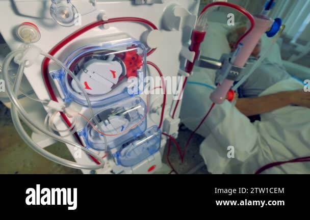 Patient during hemodialysis procedure. Modern dialysis machines making ...