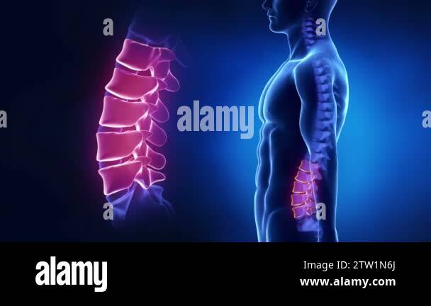 Lumbar region Stock Videos & Footage - HD and 4K Video Clips - Alamy