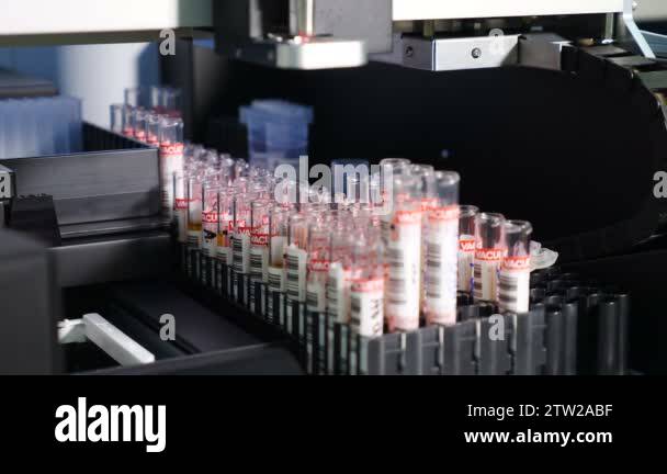 Robotic manipulator arms with containers or test tubes with blood on ...