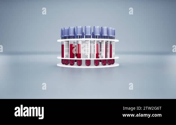 Vacutainer set Stock Videos & Footage - HD and 4K Video Clips - Alamy