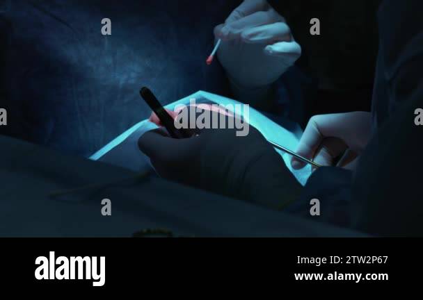 The surgeon is performing an operation on the eyes, close-up ...