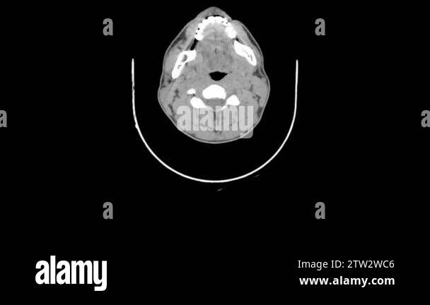 Computed tomography of the body. Examination of the head, neck, chest ...