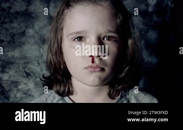 Nose bleeding child Stock Videos & Footage - HD and 4K Video Clips - Alamy