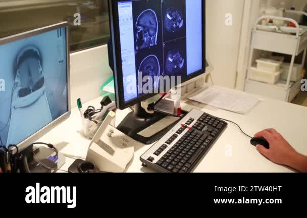Mri brain scanner monitor Stock Videos & Footage - HD and 4K Video ...