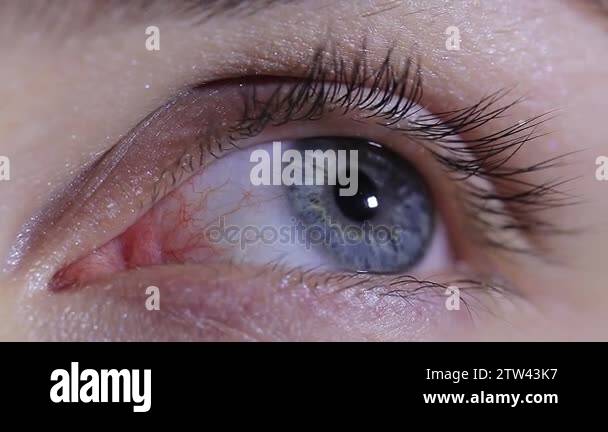 Red eyes pupil Stock Videos & Footage - HD and 4K Video Clips - Alamy