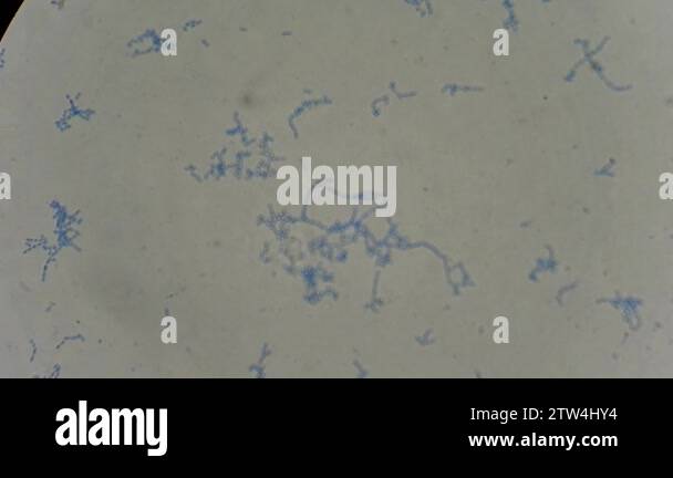Bacteria under microscope Stock Video Footage - Alamy