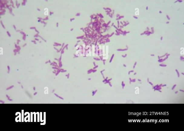 Bacteria microscope salmonella Stock Videos & Footage - HD and 4K Video ...