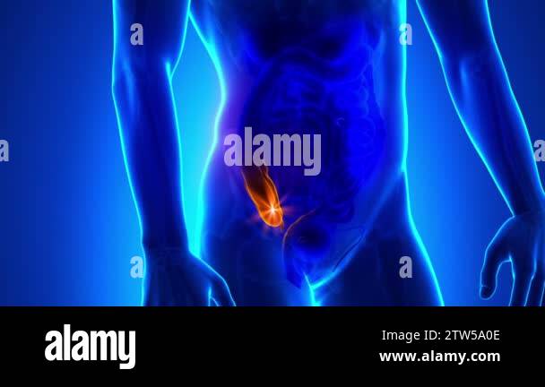 Illustration appendix appendicitis Stock Videos & Footage - HD and 4K ...
