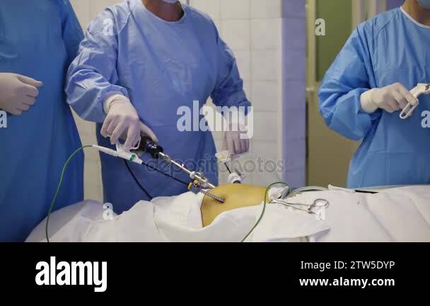 Parts of body of three doctors during endoscopic surgery in abdominal ...