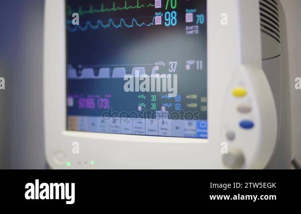 Charts of heartbeat and heart rate on screen during surgery. Text on ...