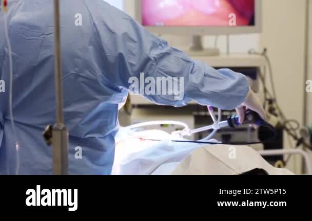 Endoscopic inspection Stock Videos & Footage - HD and 4K Video Clips ...