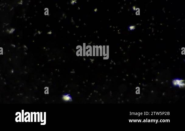 Bacillus subtilis sem Stock Videos & Footage - HD and 4K Video Clips ...