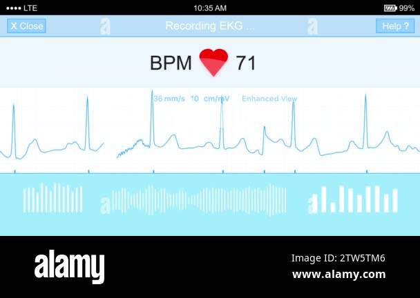 Ecg recording screen Stock Videos & Footage - HD and 4K Video Clips - Alamy