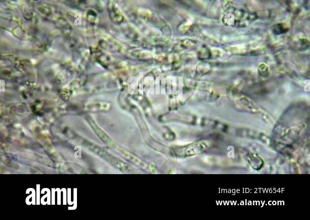 Fungal spore microscope Stock Videos & Footage - HD and 4K Video Clips ...