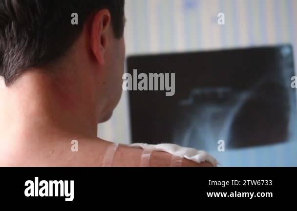 A man with a trauma to the right collarbone of various X-ray images. In ...
