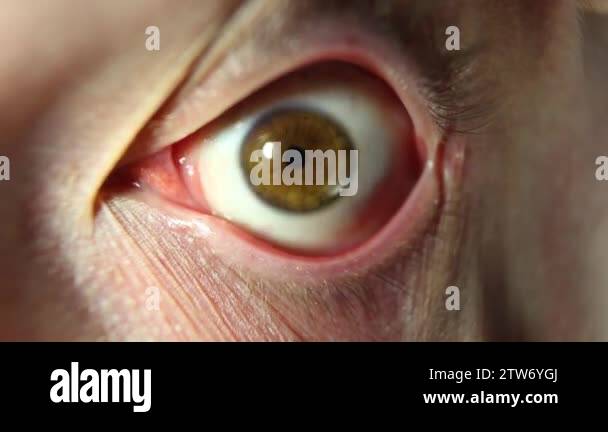 Eye Rotation Of The Eyeball. Close-up of man eye that blink, crazy ...