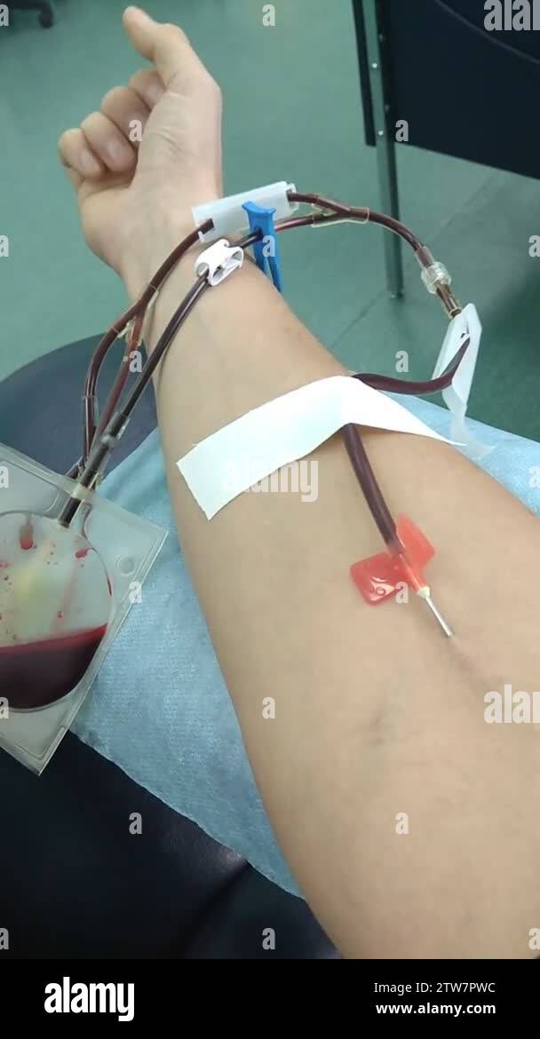 Bag blood in hand Stock Videos & Footage - HD and 4K Video Clips - Alamy