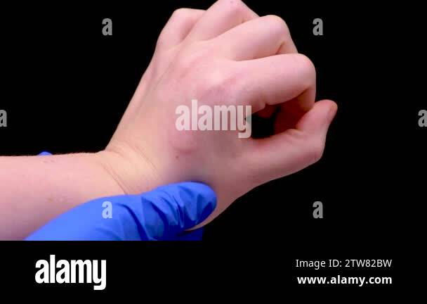 Medical bite Stock Videos & Footage - HD and 4K Video Clips - Alamy