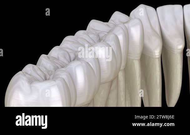 Mandibular teeth Stock Videos & Footage - HD and 4K Video Clips - Alamy