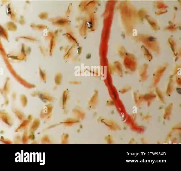 Larvae anatomy Stock Videos & Footage - HD and 4K Video Clips - Alamy
