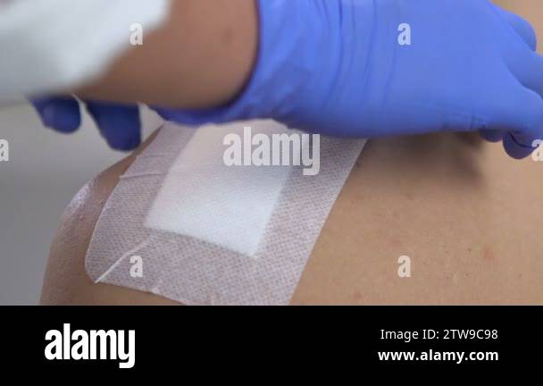 Nurse taking off adhesive bandage from male wounded shoulder, trauma ...
