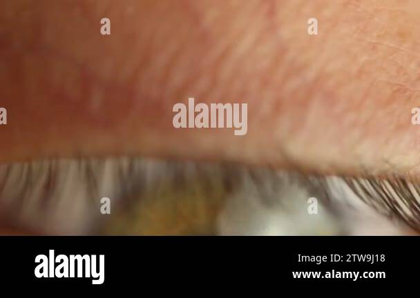 blinking male eye close-up looking around. red artery on the eyeball ...
