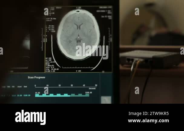Tumor x-ray results on screen with MRI machine behind, computer ...