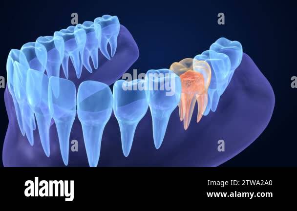 Transparent teeth. Endodontics inner structure of molar teeth. 3D ...