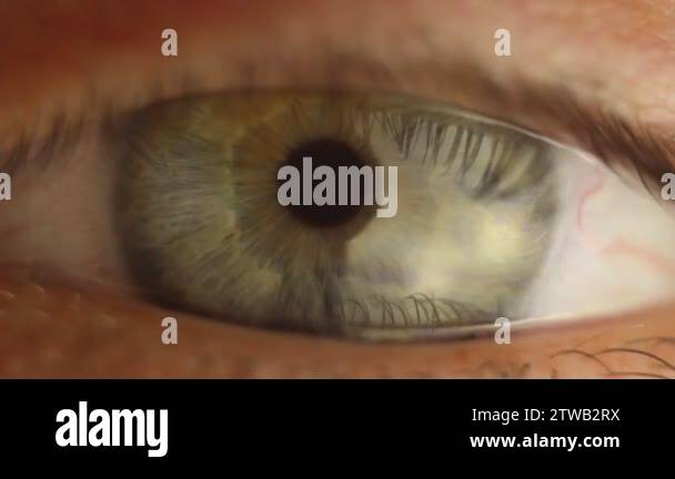 blinking male eye close-up looking around. red artery on the eyeball ...