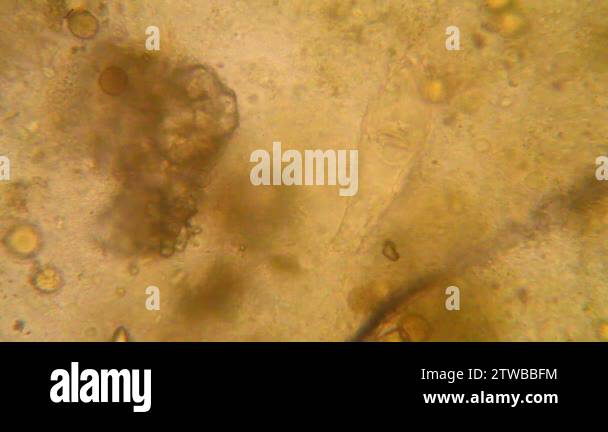 Microscopic view of organisms in the fusty water. Rotifers Stock Video ...
