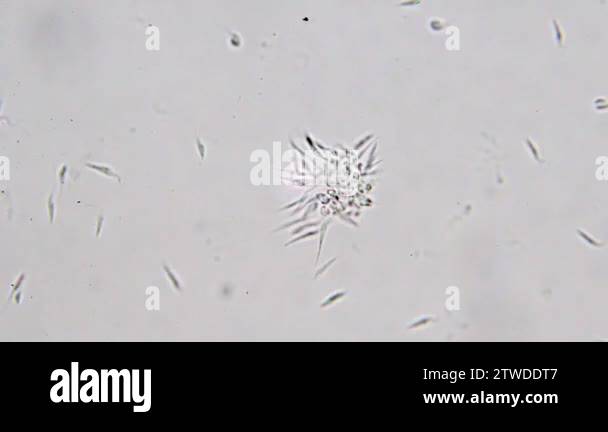 Trypanosoma cruzi microscope view; agent of the human killing Chagas ...