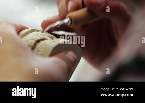 Dentist makes a dental implant prosthesis made of plaster cast ...