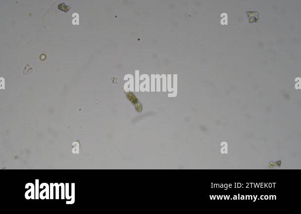 Baby of triops under a microscope. The microscopic world Stock Video ...