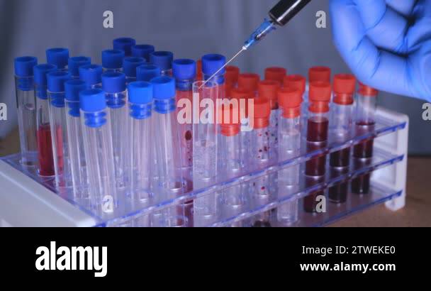 Lab work doctor holds pipette Stock Videos & Footage - HD and 4K Video ...