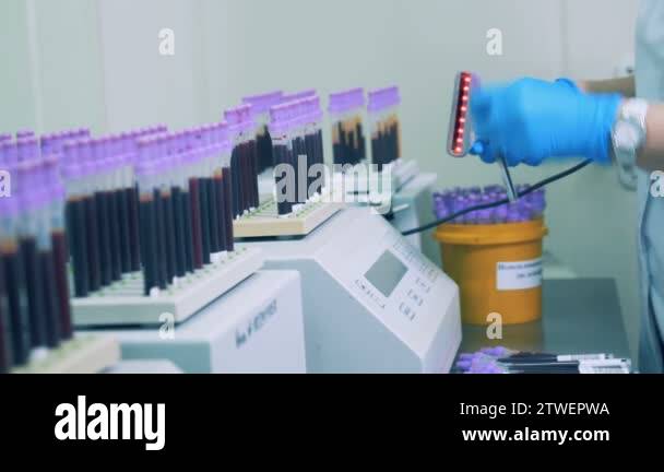 A woman scans bar codes on blood samples, close up. Laboratory worker ...