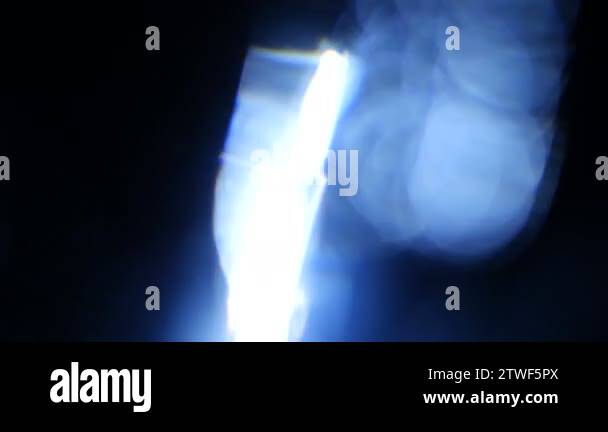 Leakage of light at hand. Film Burn Overlay Lifetime.Light pulses and ...