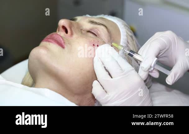 Cosmetic botox injection Stock Videos & Footage - HD and 4K Video Clips ...