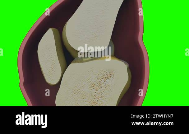 human knee, knee, 3d rendered knee illustration, pain illustration knee ...