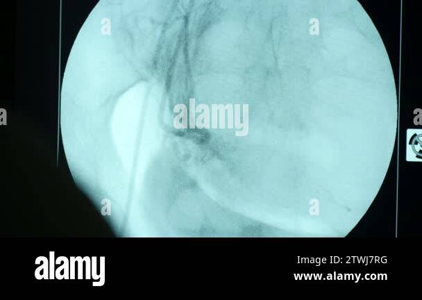 Cutting edge Xray scanner with a big blue screen in the black backdrop ...