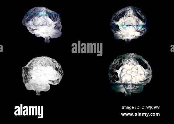 Four brains spinning with mri scanning on black background, health ...