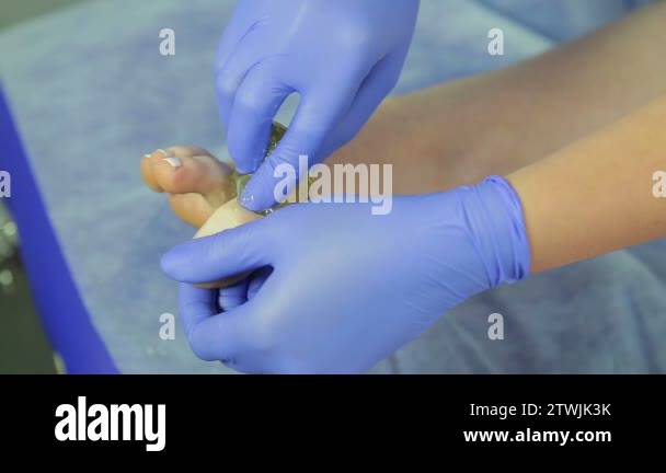 The hands of the beautician woman remove the hair from the girl's toes ...